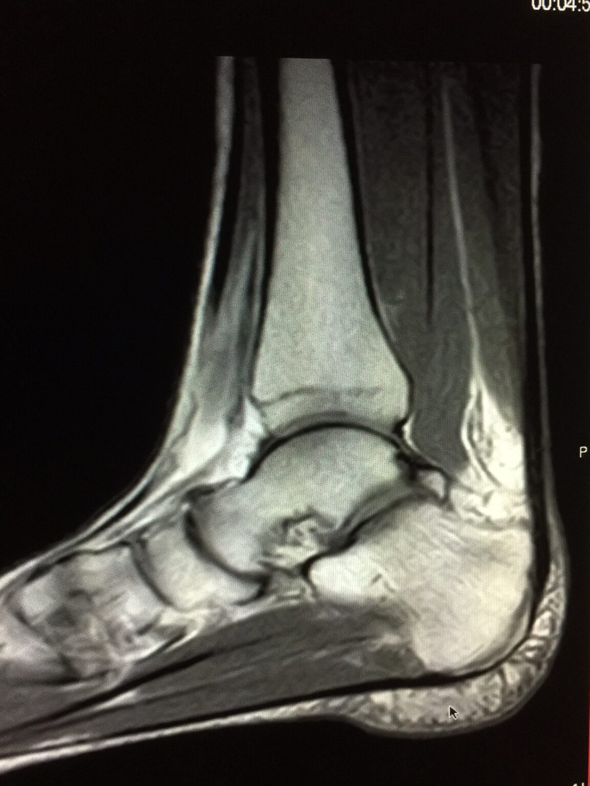 About Open MRI Center