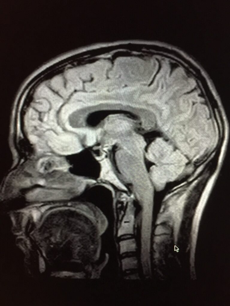 About Open MRI Center